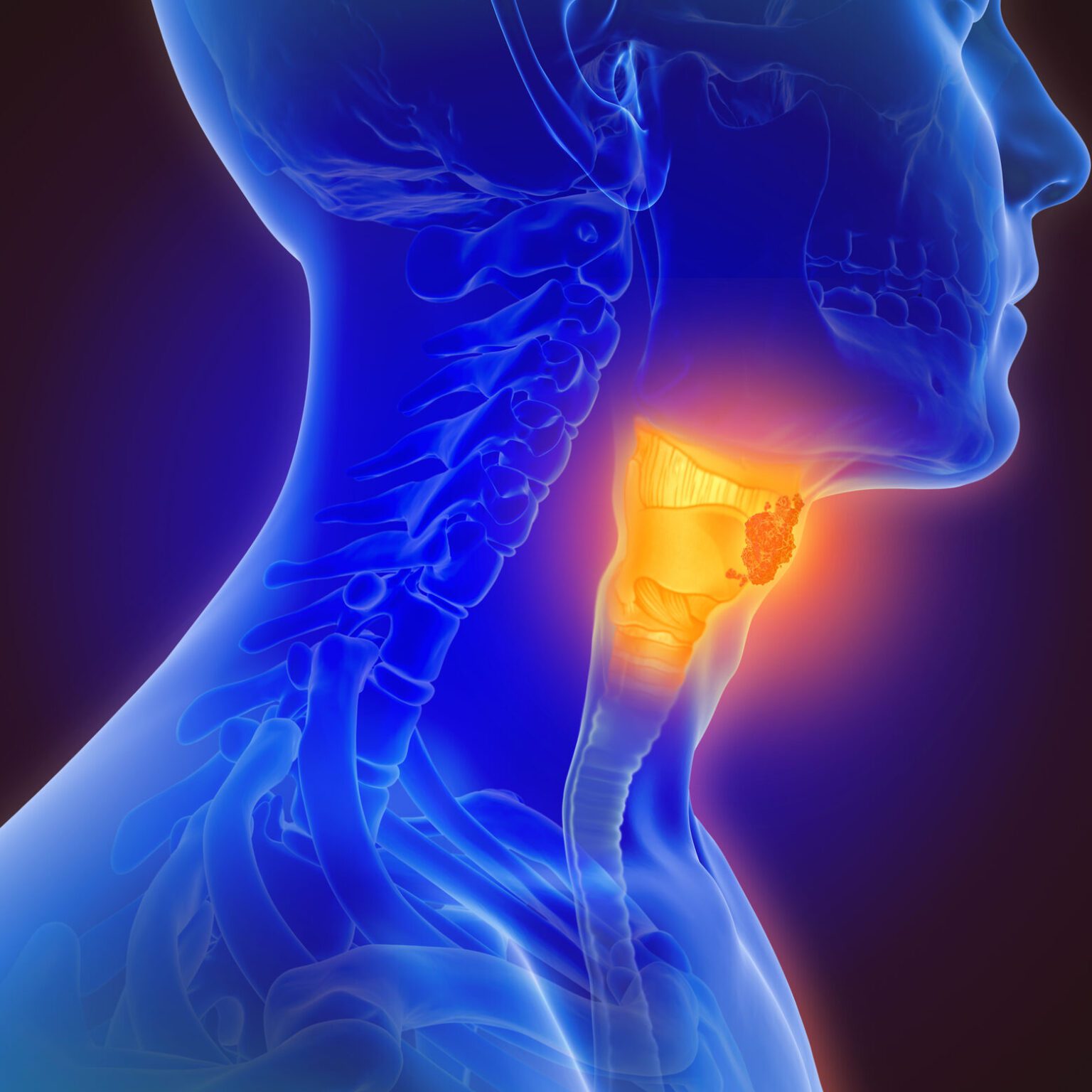 Understanding the Spiritual Meaning of Sore Throat: Significance and ...