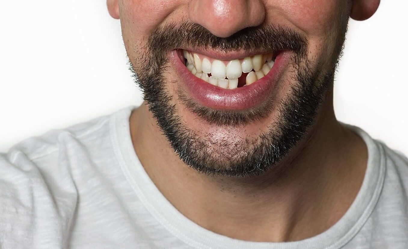 The Spiritual Meaning of 3 Teeth Falling Out Dream: A Guide to ...